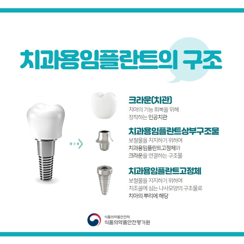 [카드뉴스] 치과용임플란트에 대해 알아보아요 기관별 공지사항 알림마당 의료기기산업정보 종합정보시스템